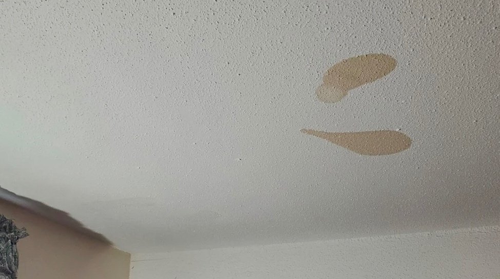 Mom left horrified after finding out the real reason dark patches were ...